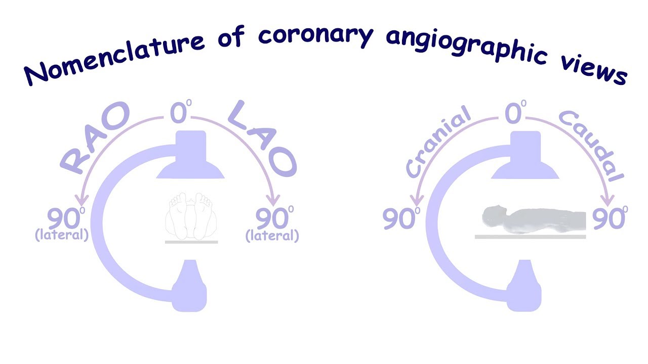 Coronary angiography. Lesson 2: nomenclature of coronary angiographic ...