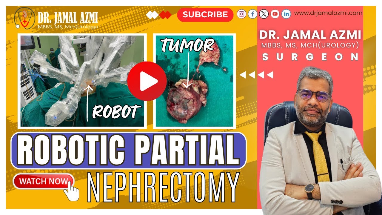 Robotic Partial Nephrectomy: Lower Pole Right Kidney Tumor | Surgical ...