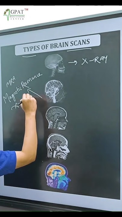 Type of Brain Scan #mri #magnatic #braintest #scan #computedtomography ...