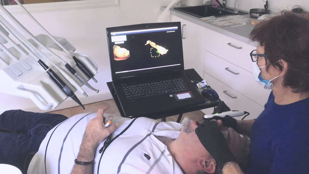 Full arch scan with Condor - YouTube