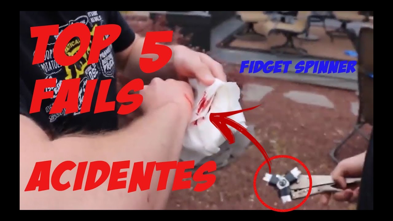 TOP 5 FAILS FIDGET SPINNER HAND SPINNER #3 ACIDENTES LESÕES LESION ...