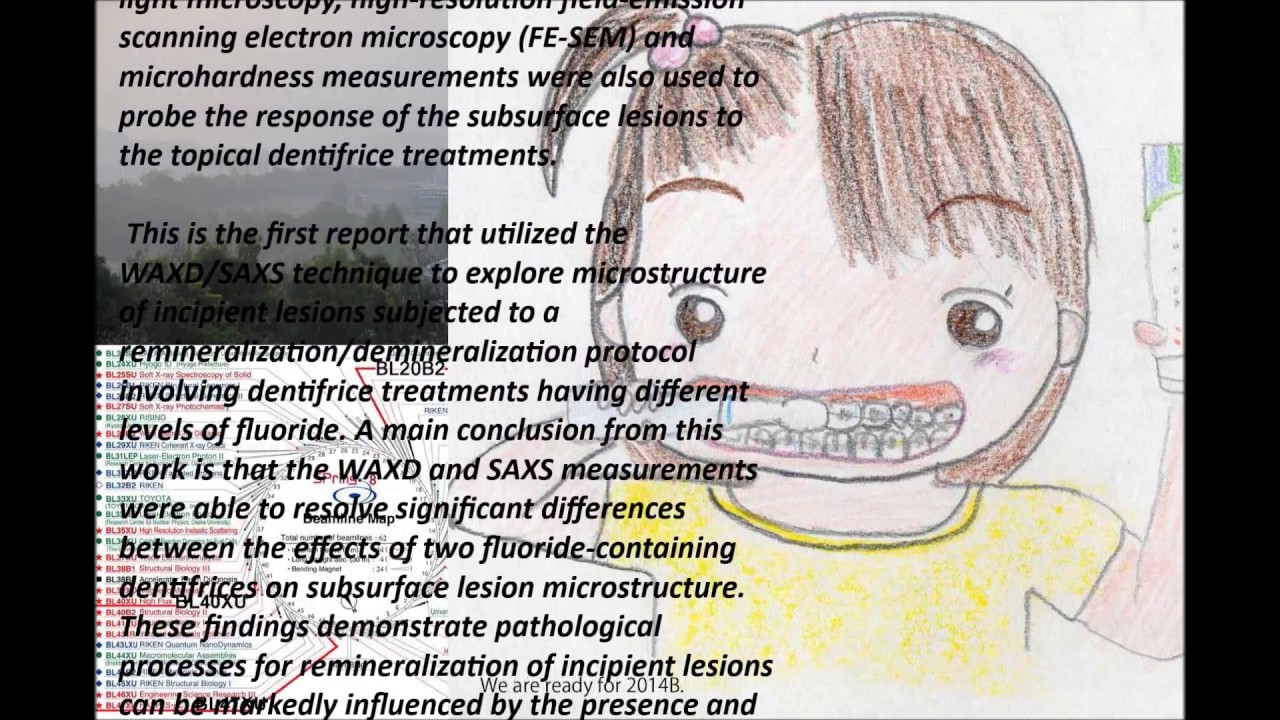 Observations of Enamel Microstructure in Incipient Lesions ...