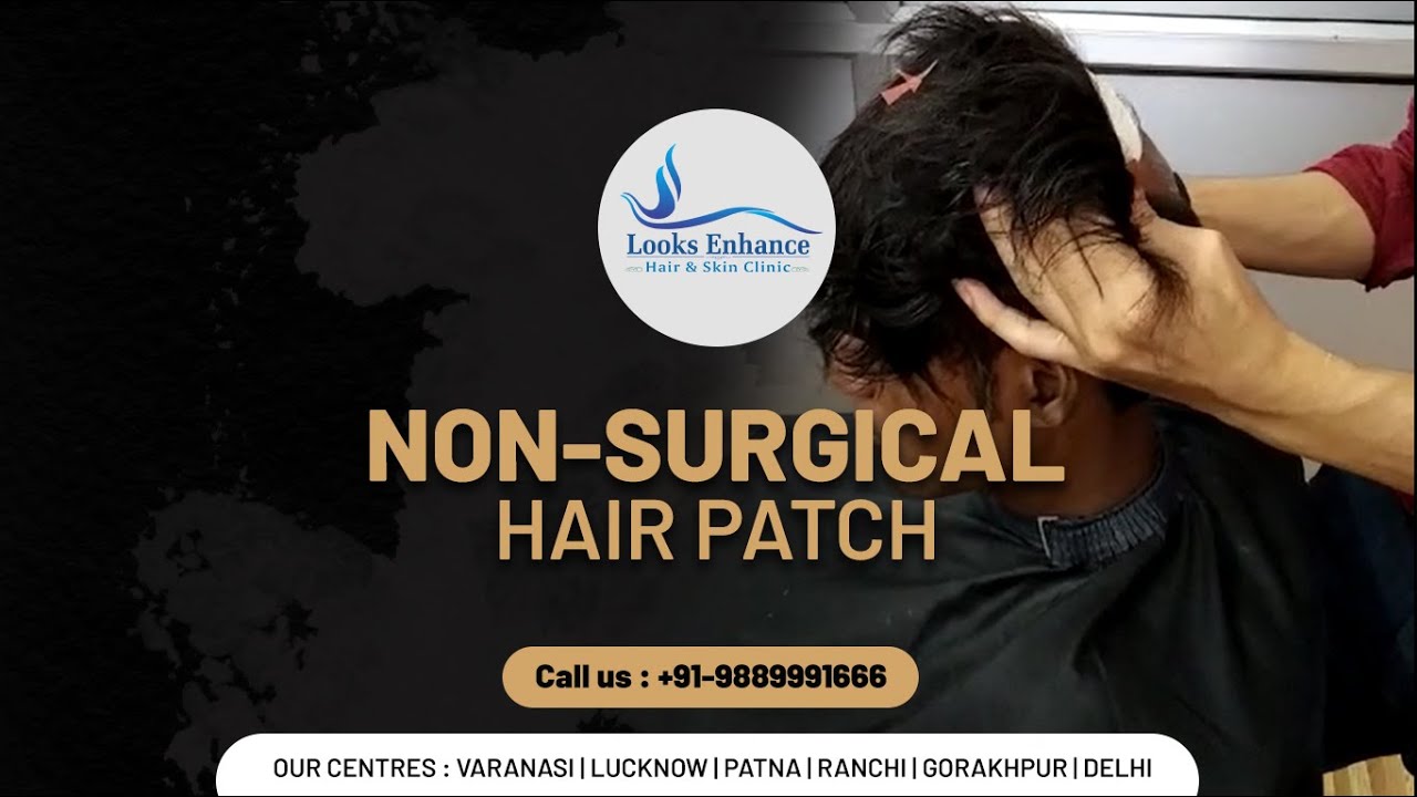 Hair Patch In Patna Clip System Hair Patch In Patna Looks Enhance