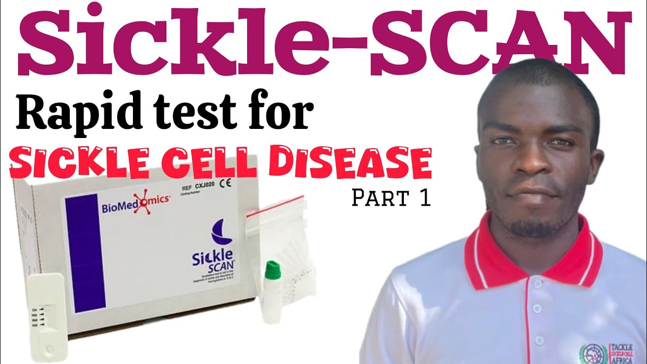 SickleSCAN: A rapid diagnostic test for sickle cell from BioMedomics ...
