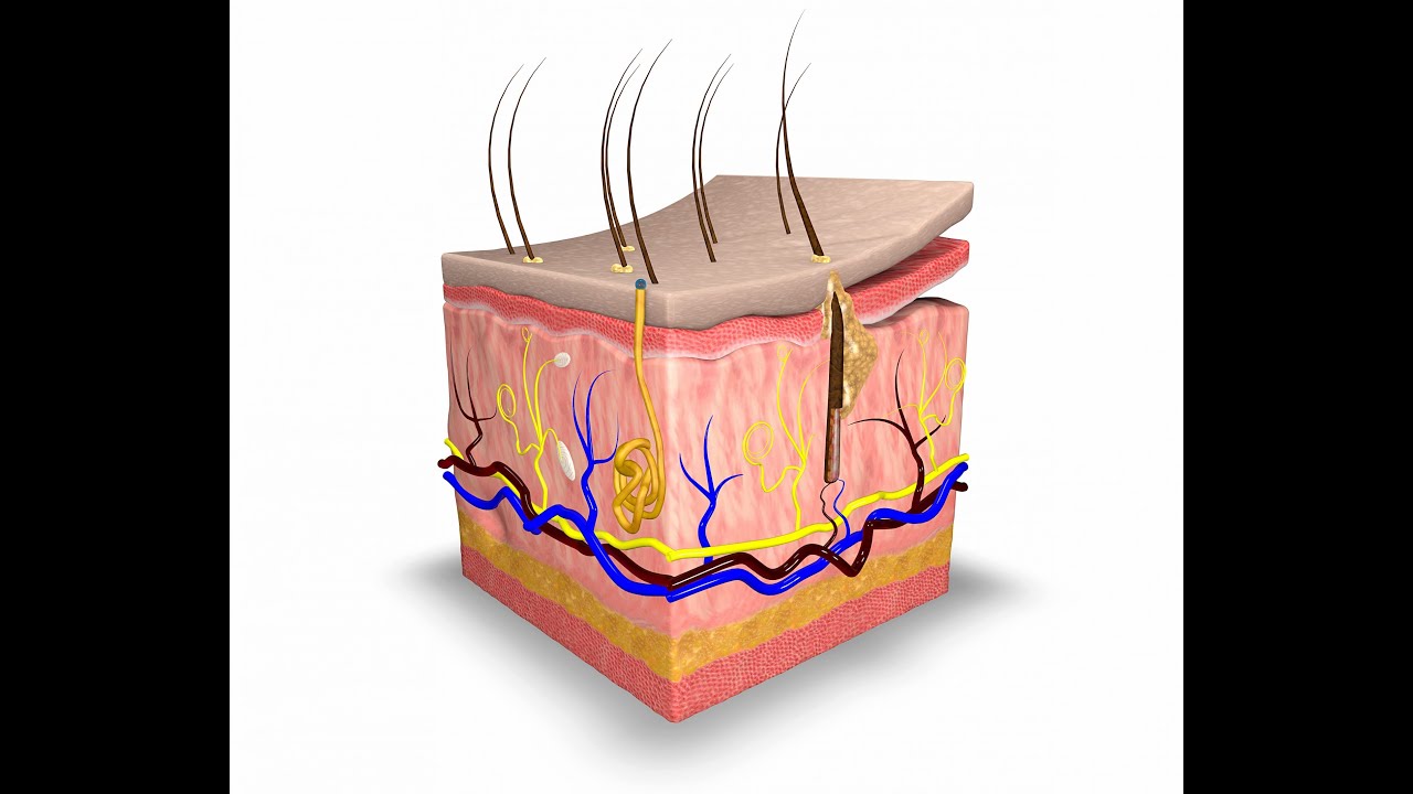 5. SKIN PATHOLOGY, INFLAMMATORY-LECURE - YouTube