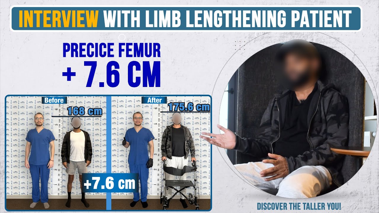 INTERVIEW WITH LIMB LENGTHENING PATIENT - Precice Method / +7.6 cm ...