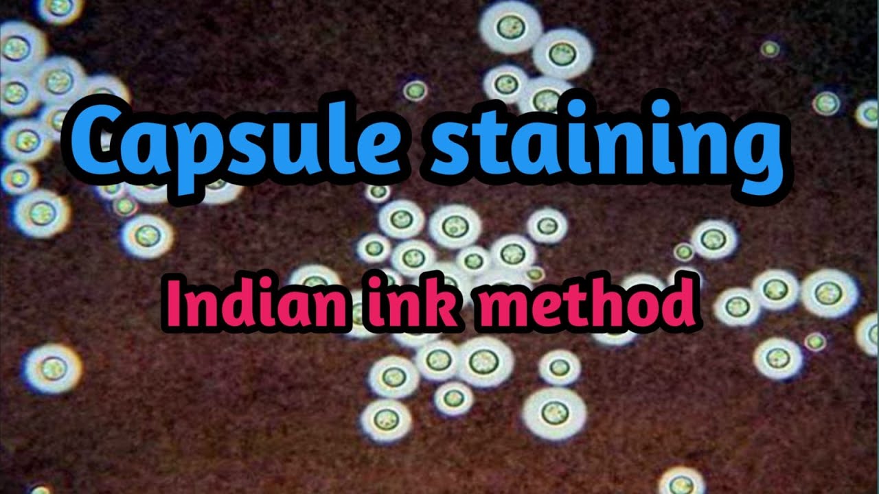 Capsule Staining - Indian ink method - YouTube