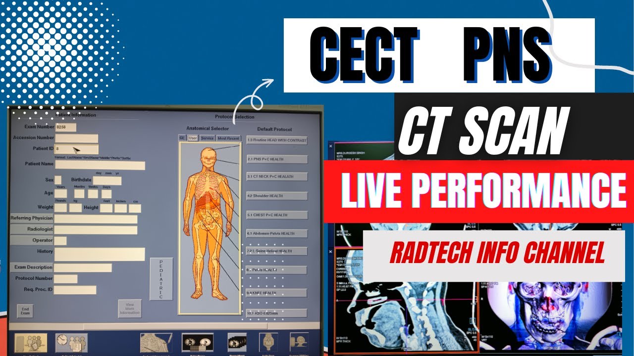Live pns paranasal sinusitis ct scan with contrast GE Machine Learning ...