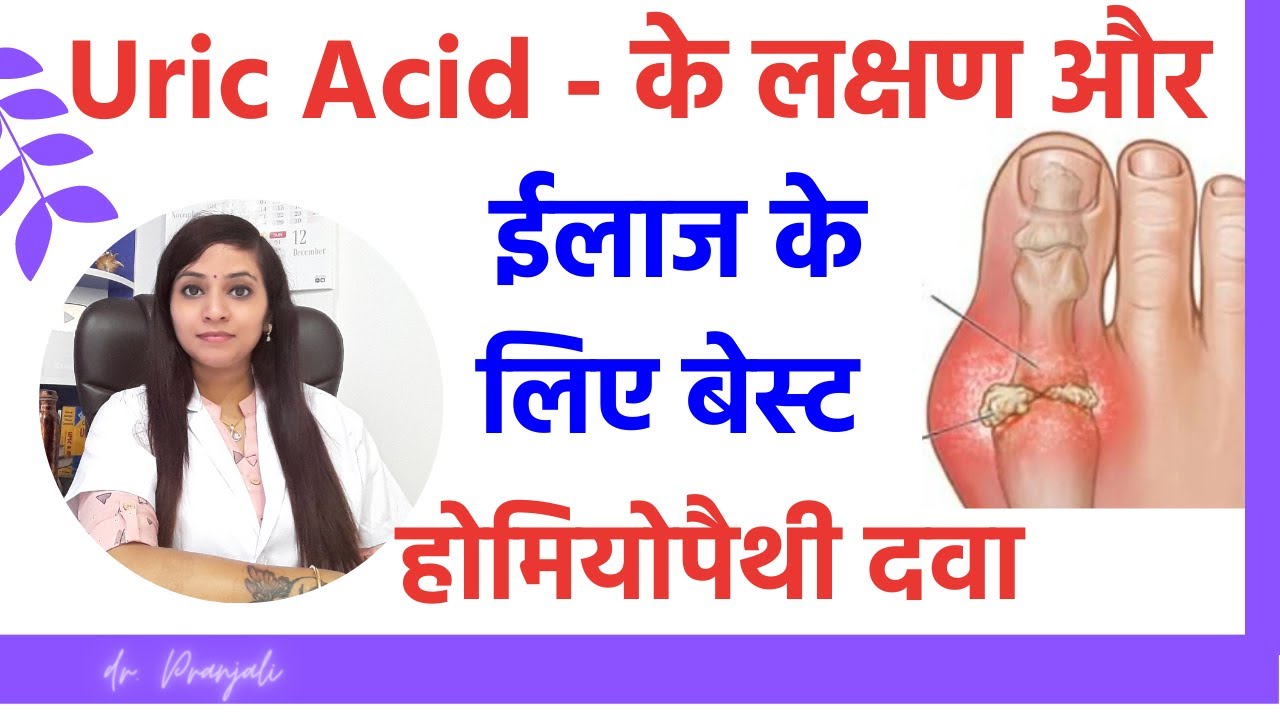 यूरिक एसिड का इलाज | uric acid ke lakshan | uric acid kam karne ke upay, kaise hota hai and dava ...