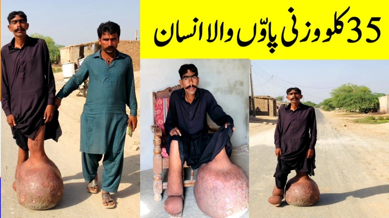 35Kg Wazni Foot Wala insan😥 - YouTube