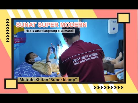 Sunat Modern Tanpa Jarum Suntik | Super Klamp