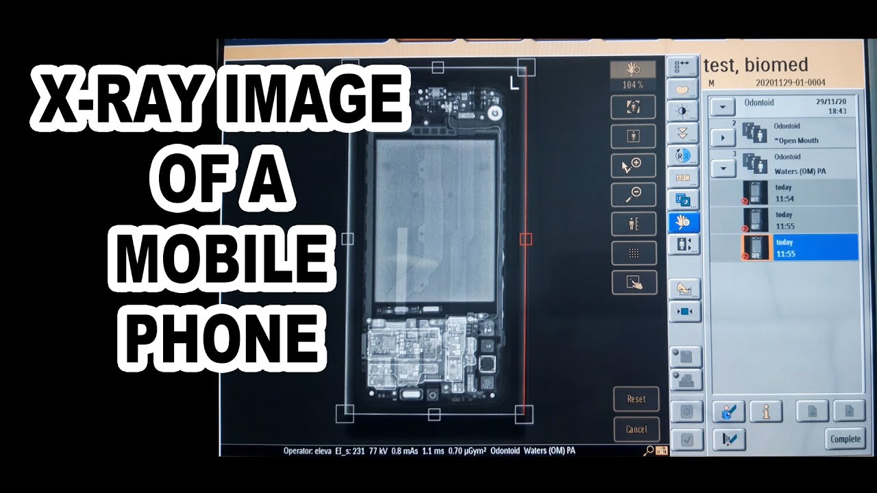 X-Ray Image of a Mobile Phone - YouTube