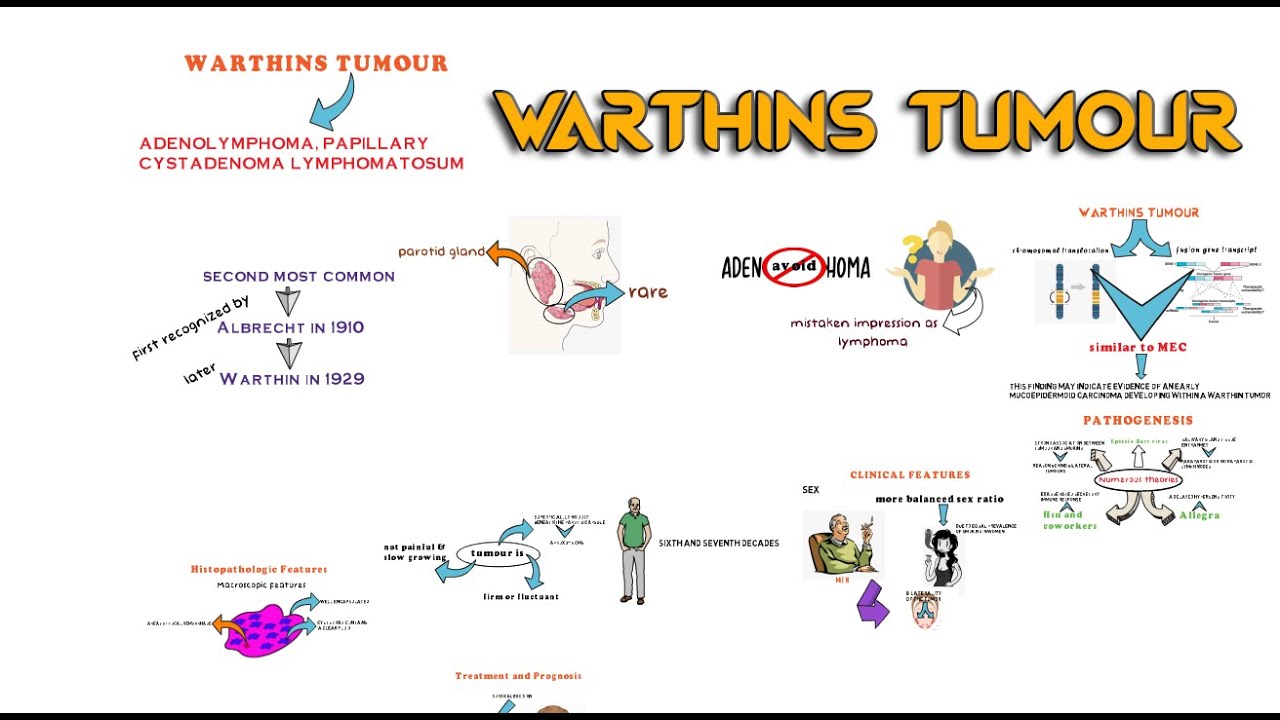 Warthins tumour / Adenolymphoma / Papillary cyst adenoma lymphomatosum ...