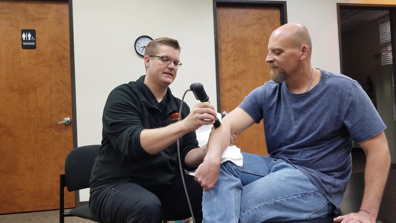 Radial Shockwave Therapy (aka Radial Pressure Wave Therapy) for Elbow ...