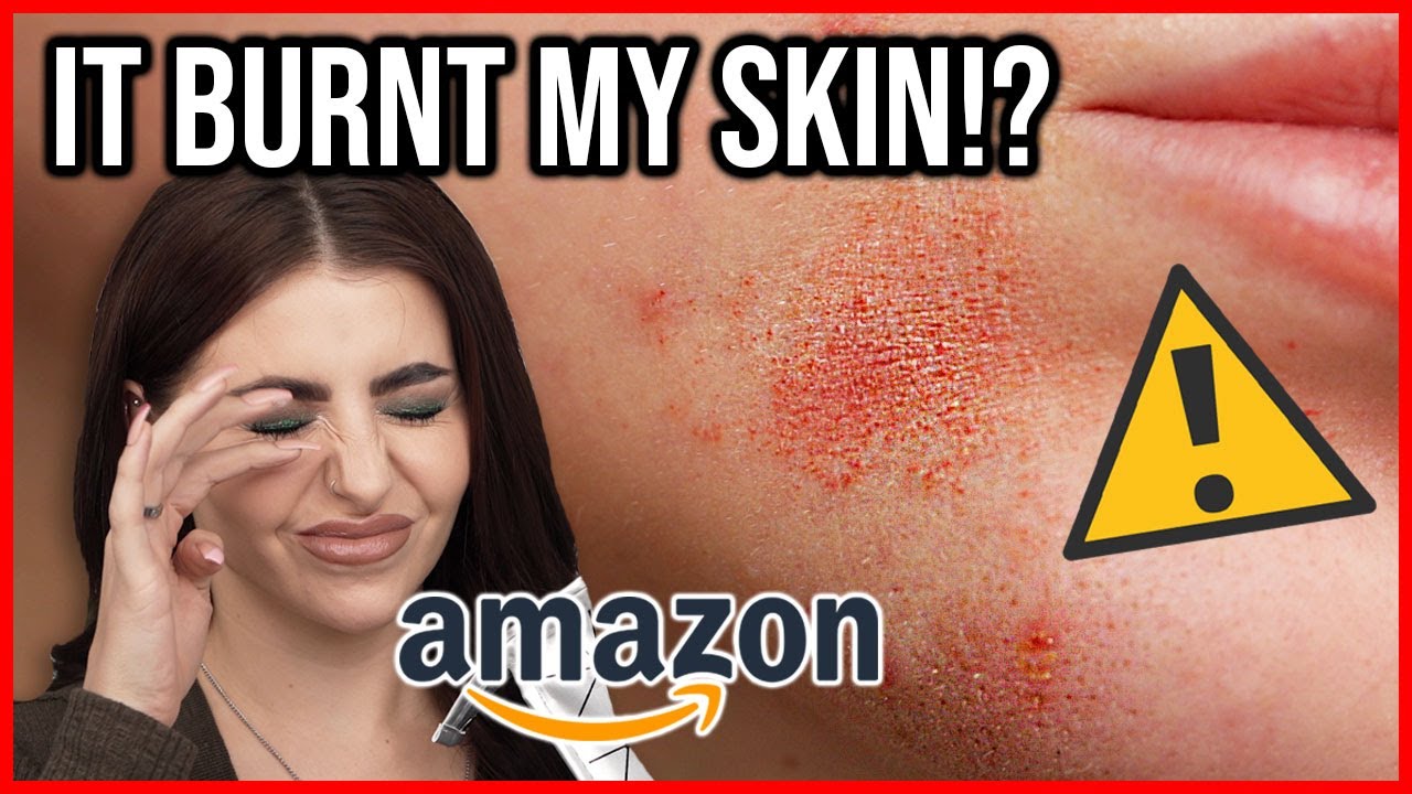 This BURNT My Face!? ⚠️ Testing £35 *AMAZON* Makeup Kit! - YouTube
