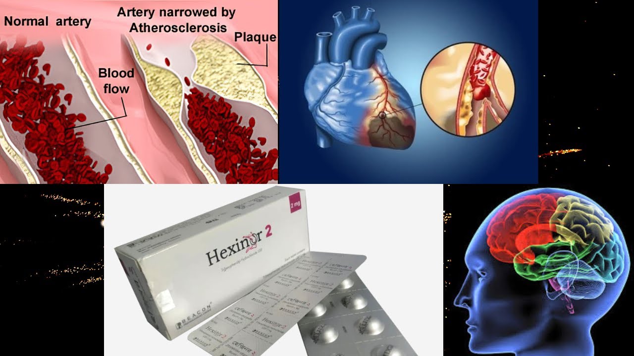 Hexinor Tablet এর কাজ এবং খাবার নিয়ম | মস্তিষ্ক এবং হাত পা কাপার ...