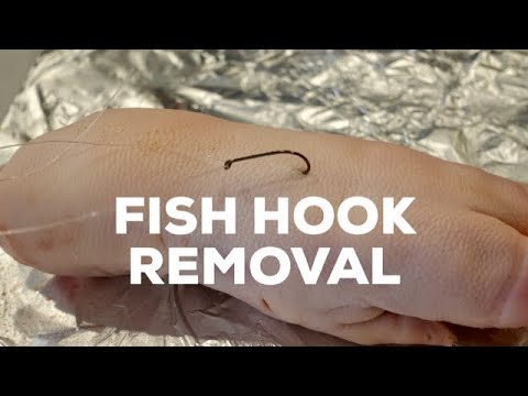 How to remove a fishing hook- EASY - YouTube