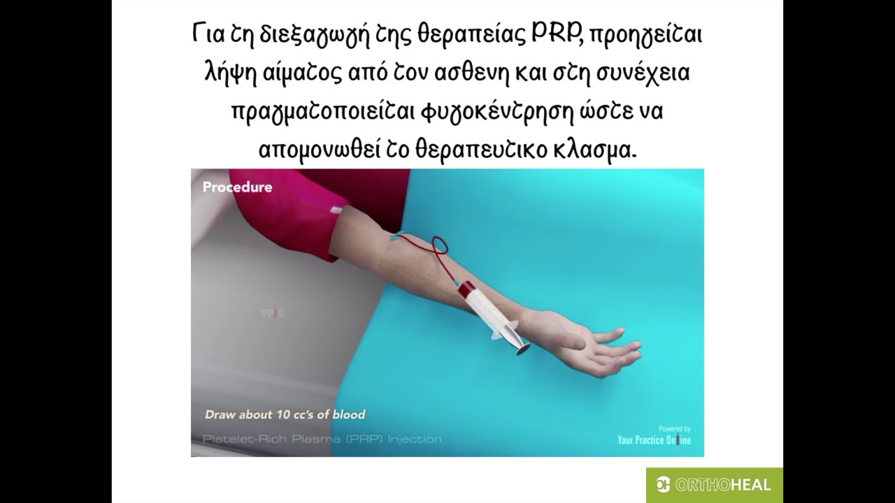 012: Πελματιαία Απονευρωσίτιδα (άκανθα πτέρνης)και πλάσμα πλούσιο σε ...