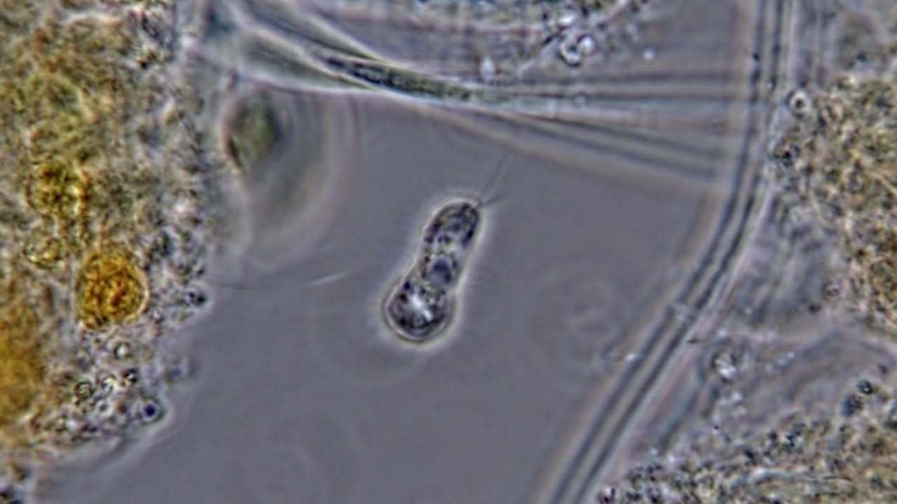 Paraphysomonas - Presenting Two Anterior Flagella In A Pre-Division ...