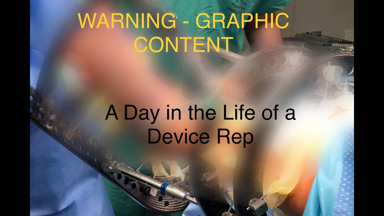 A Typical Day for Device Reps - A Day in the life - Medical Sales - YouTube