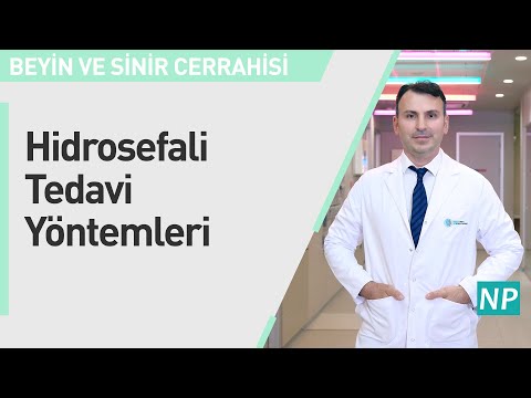Hidrosefali Tedavi Yöntemleri