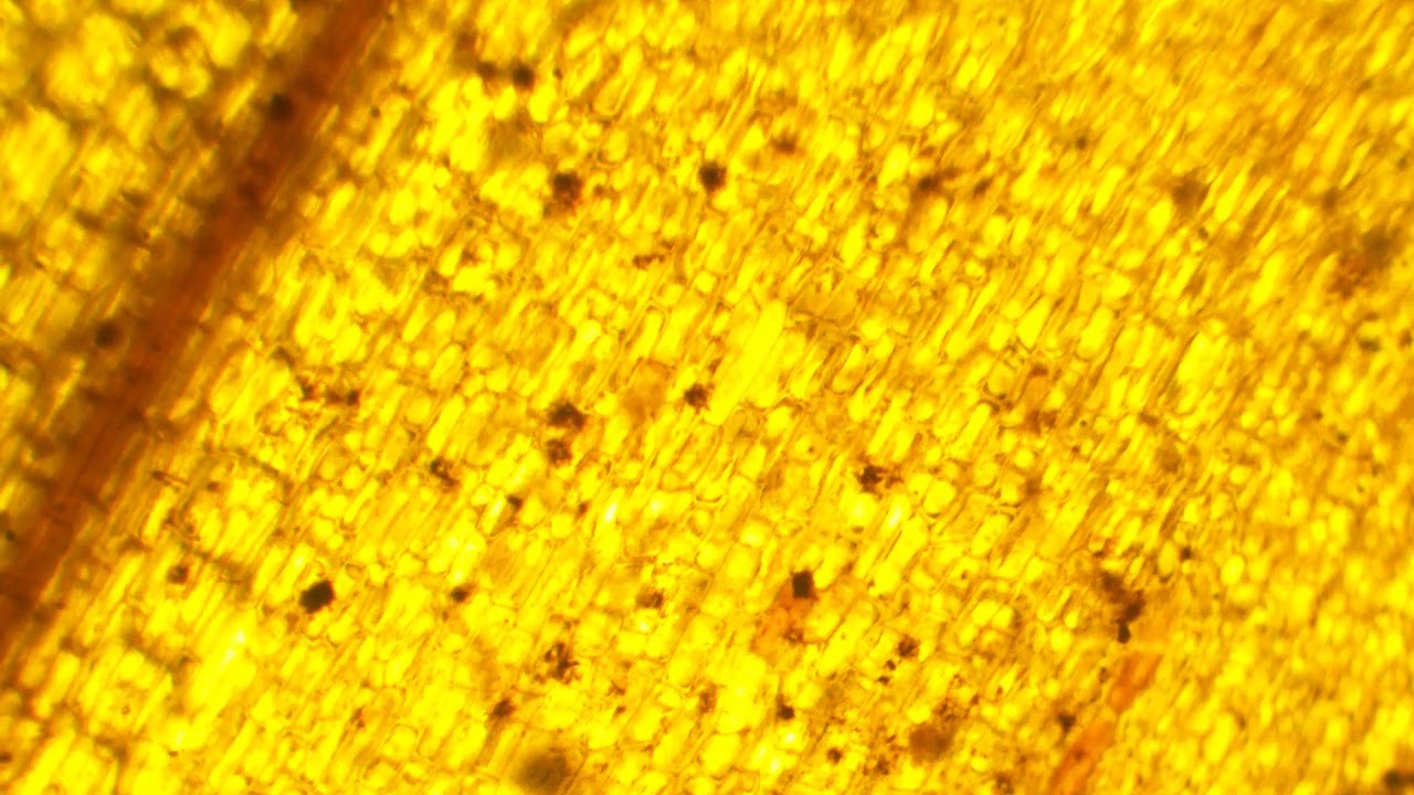 Elodea, no light stained with IKI solution - YouTube