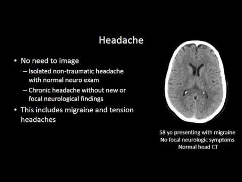Migraine Brain Mri