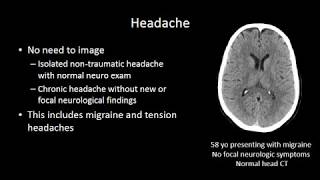 What Does A Migraine Look Like On A Ct Scan Ct Scan Machine