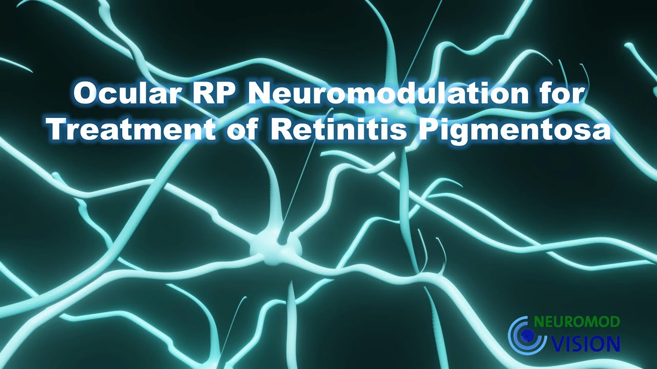 Ocular RP Neuromodulation as a Novel Treatment for Retinitis Pigmentosa ...