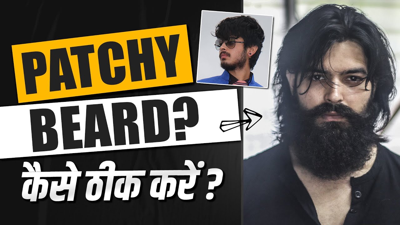 PATCHY BEARD? 100% natural SOLUTION | How to Grow beard | beard growth tips | Beard Growth ...