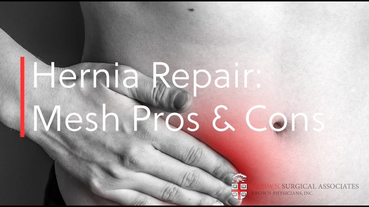 Pros and Cons of Mesh Hernia Repair - YouTube