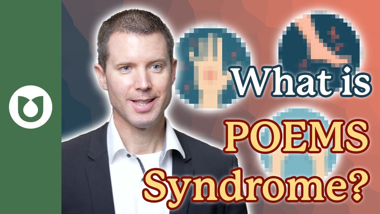 What Is POEMS Syndrome—and How Is It Linked to Myeloma? - YouTube