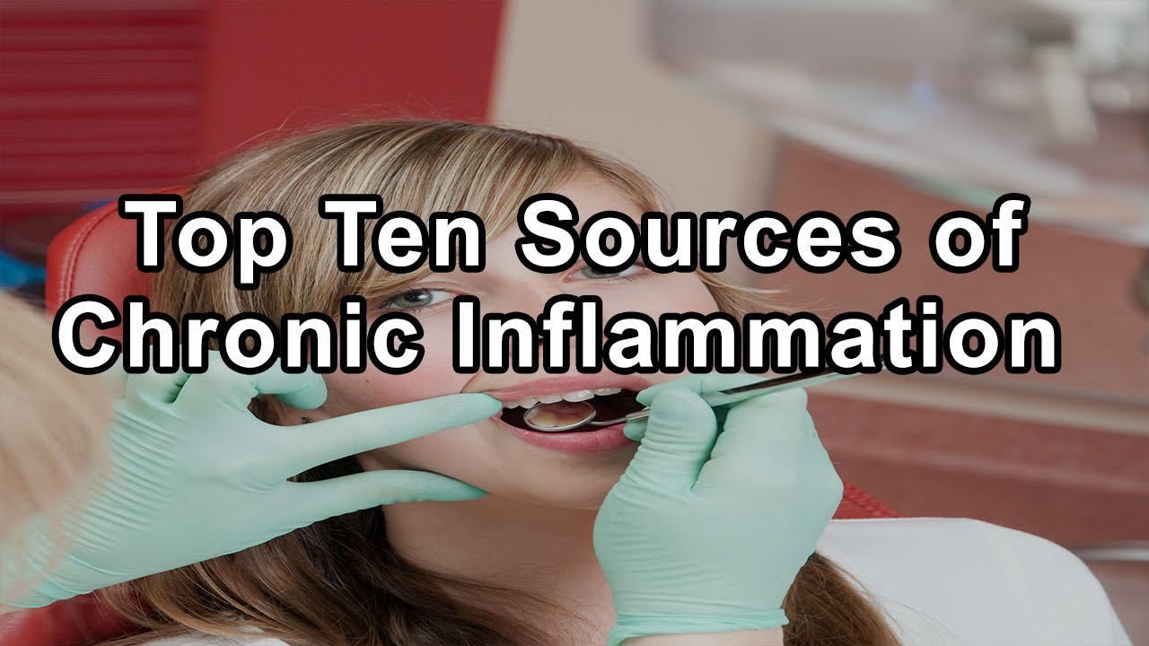 Top Ten Sources of Chronic Inflammation and Toxicity in the Mouth With Holistic Dentist - YouTube