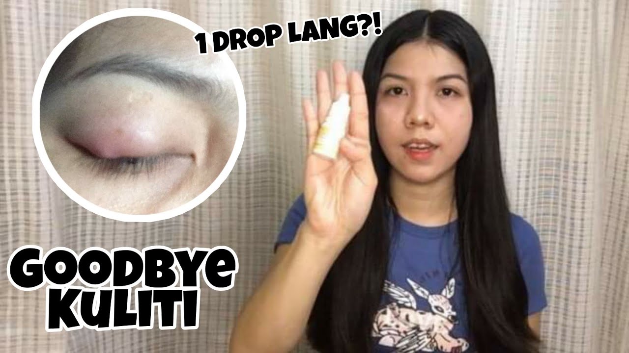 Gamot sa Kuliti recommended by Ophthalmologist Doctor - YouTube