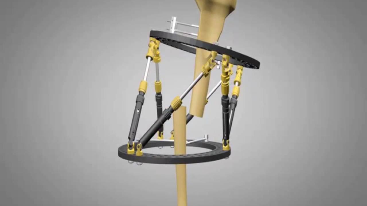 Spider Frame - YouTube