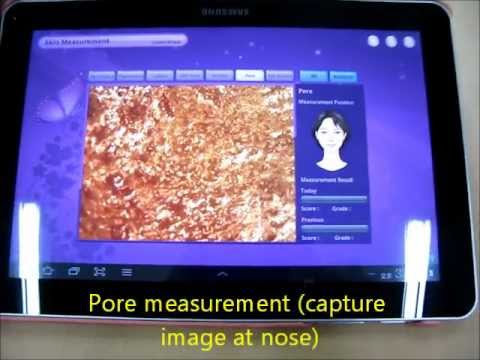 skin analysis application using MSS wireless scope (skin, scalp or hair ...