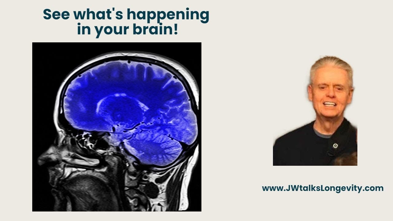 How to Read Your Own Mind: Neuro Imaging Secrets Revealed! - YouTube