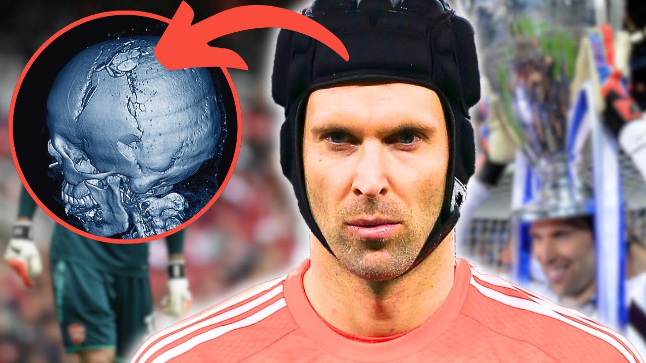 The Story of the Goalkeeper Who Survived Football's Worst Injury - YouTube