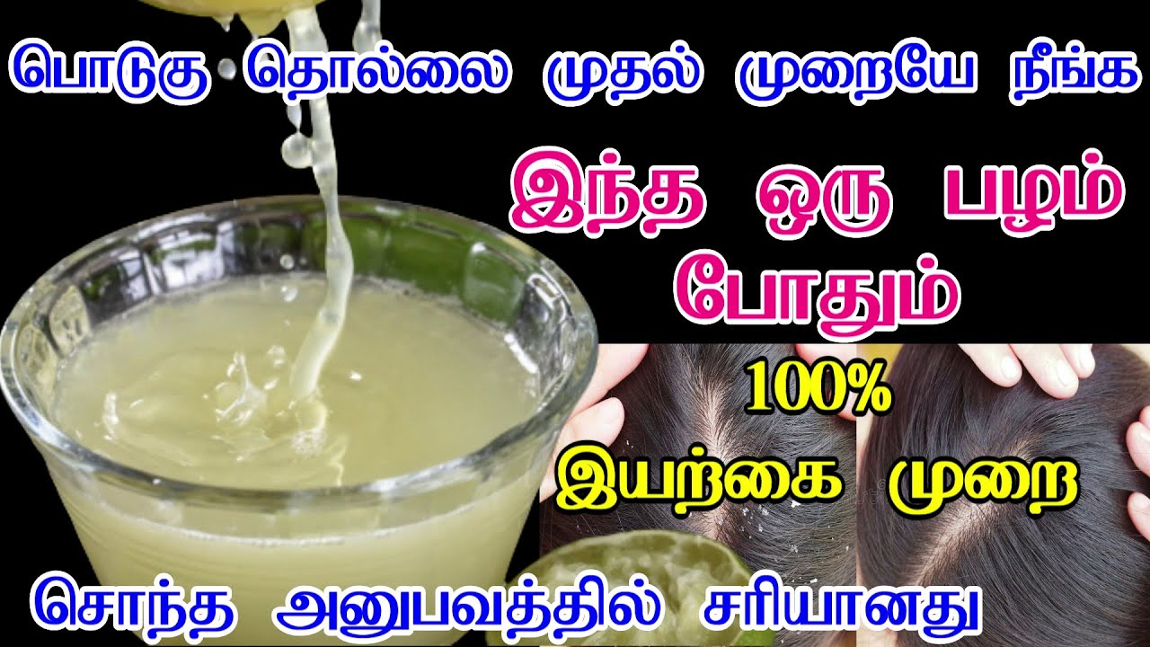 Podugu Poga Tips Tamil | How To Remove Dandruff Permanently | Hair Care ...