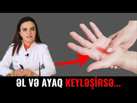 Əl və Ayaqda Yaranan Keyləşmənin Səbəbi Bunlar Ola Bilər! - MÜTLƏQ BAXIN!