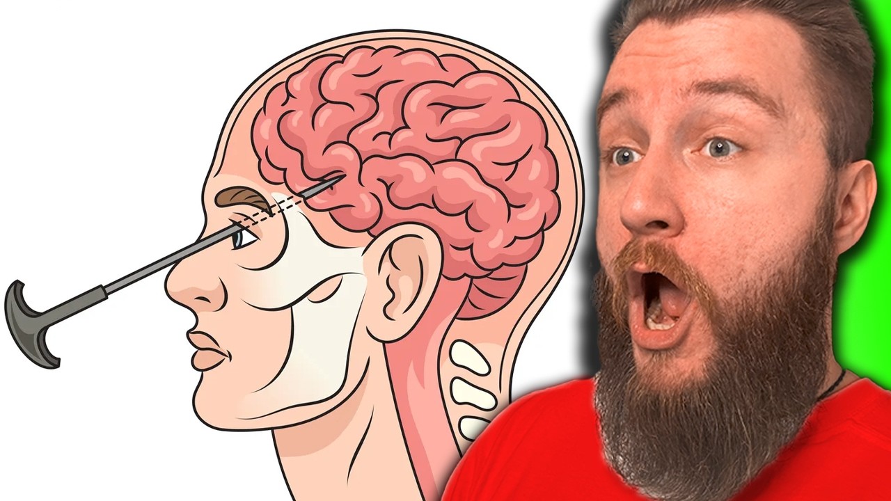 Tak Leczono PSYCHOPATÓW! - Diabeuu Ogląda Kolega Ignacy - YouTube