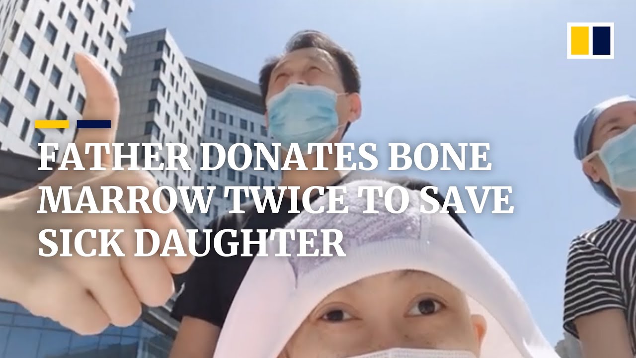 Father in China donates bone marrow twice to save daughter with ...
