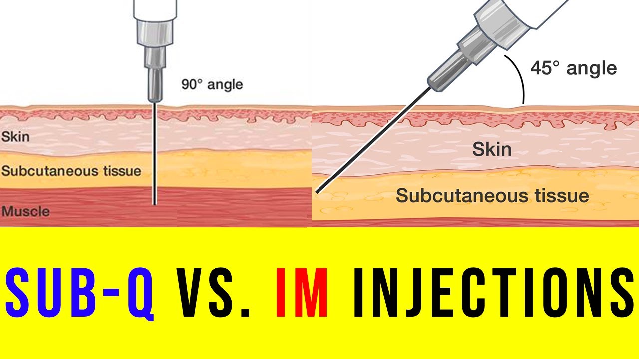 Sub-Q vs IM Injections for Testosterone Replacement Therapy? - YouTube