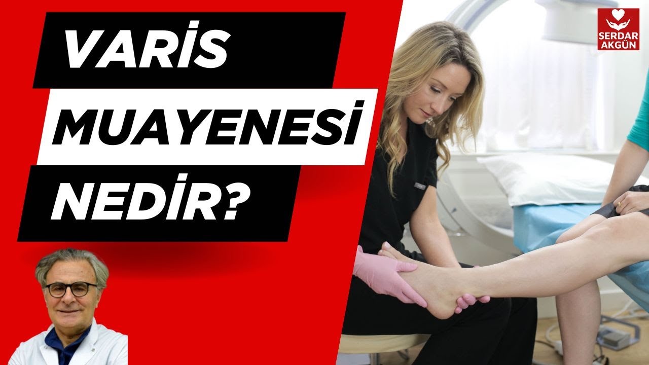 Varis, Varis Muayenesi, Sağlık, Prof.Dr.Serdar Akgün - YouTube