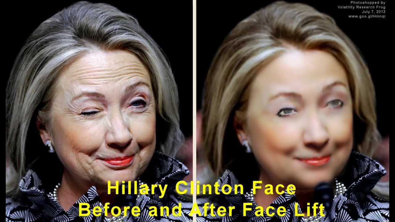 BREAKING NEWS Hillary Clinton Face Before and After Face Lift #193 ...