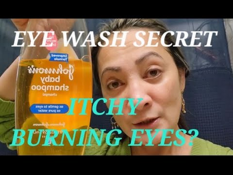 I SHOULD KNOW BETTER, ITCHY BURNING EYE, EYE MAKE-UP ALLERGY! BENEFITS ...