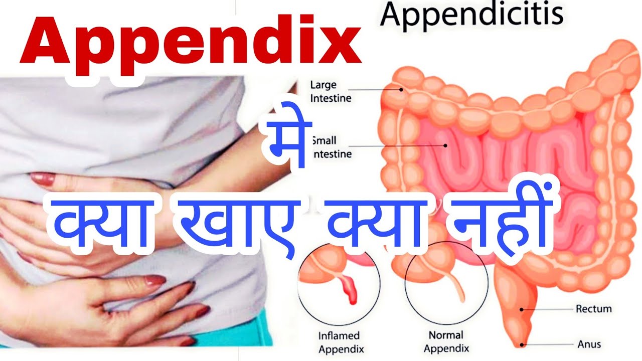 Appendix diet plan। Appendix me kya khaye kya nahi। Appendix me kya ...