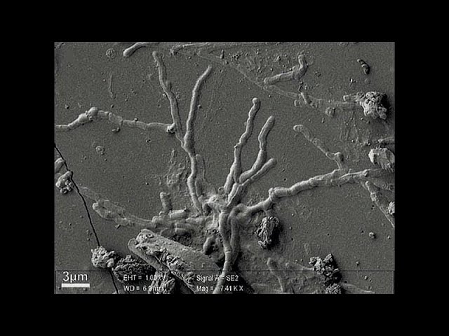 Microscopio Optico De Neuronios Neurônio No Microscópio