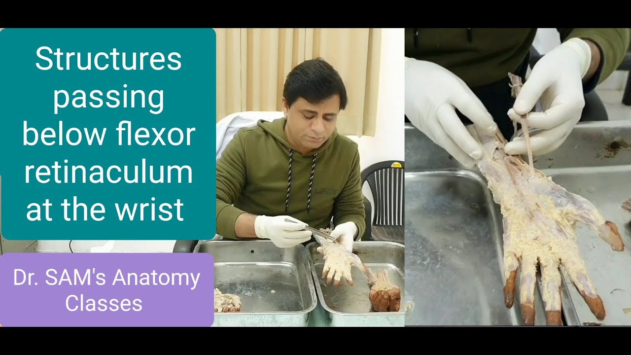 Palm | Flexor Retinaculum | Front of Forearm | Carpal Tunnel ...