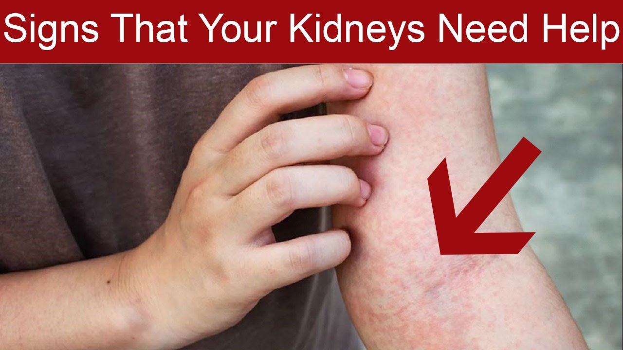Signs That Your Kidneys Need Help - YouTube